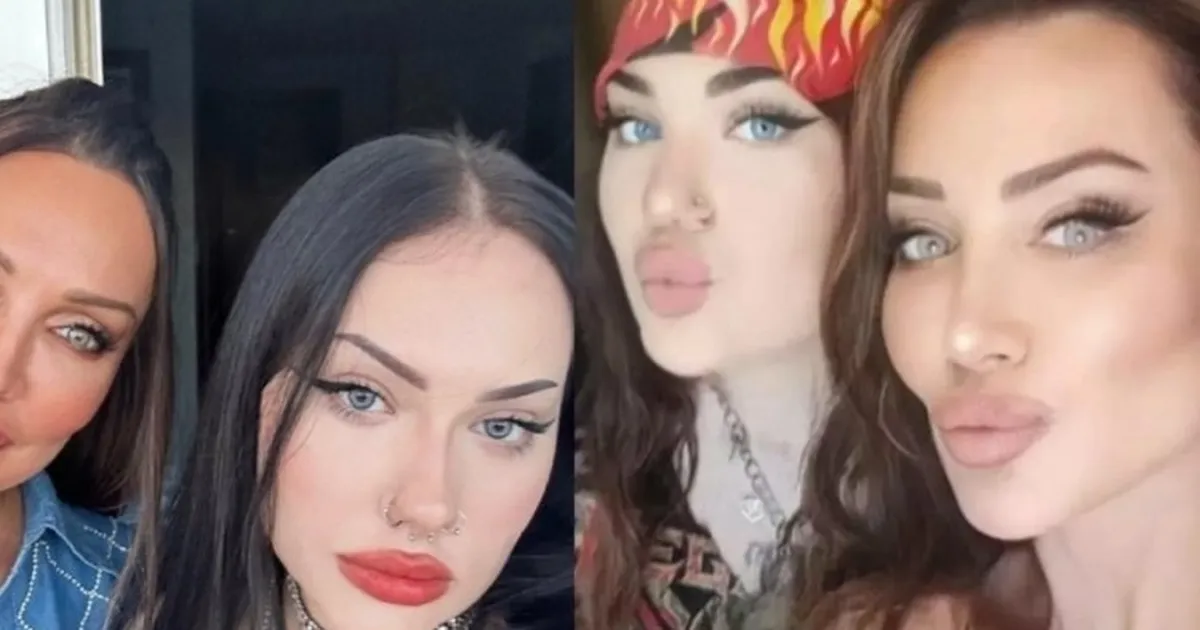 Umut Akyürek kızı Melek Bal'ın son halini paylaştı - Bursa 5n1k